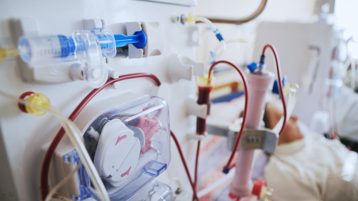 4 Things You Should Know About Hemodialysis in Pompano Beach - First ...