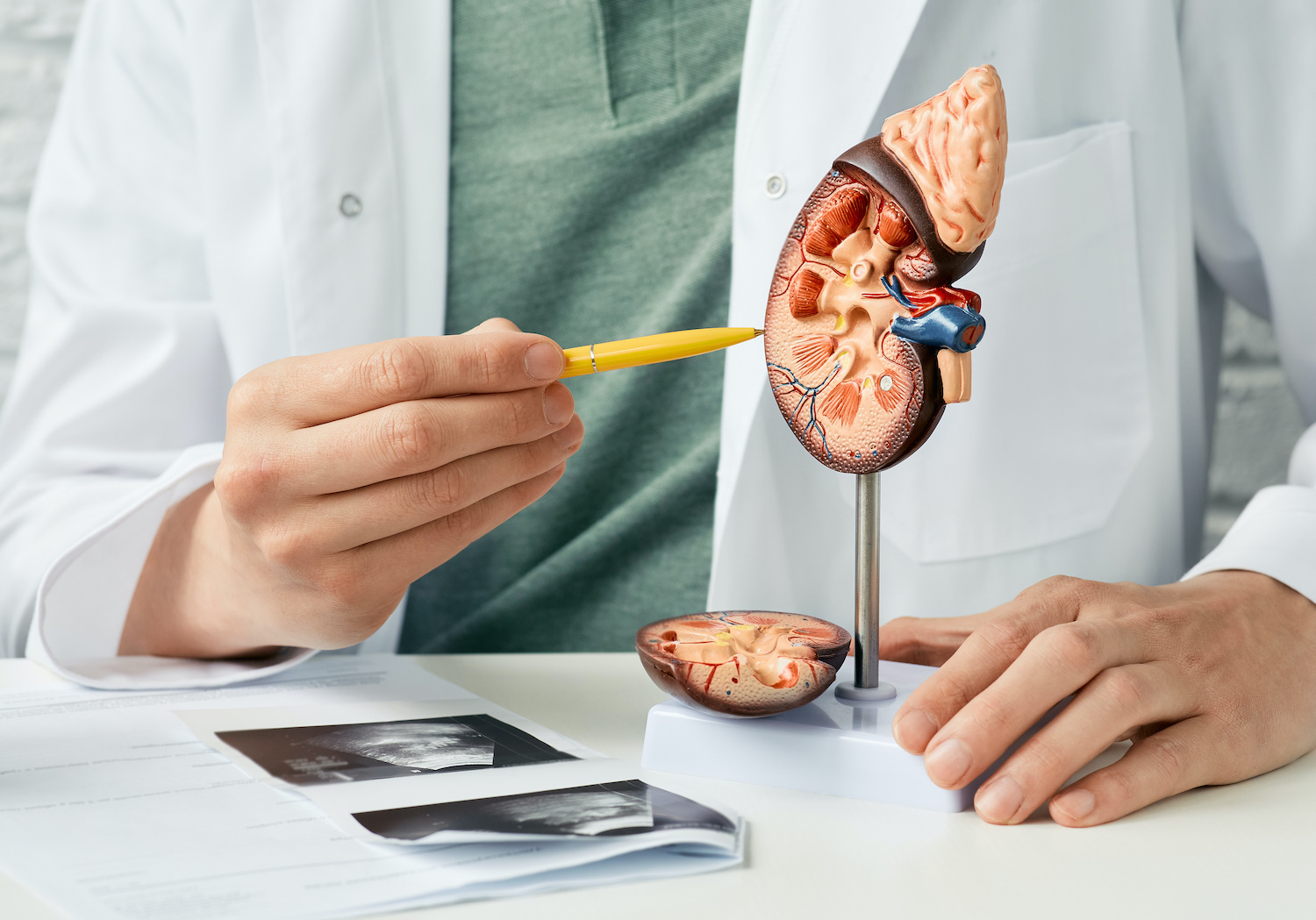 How Do You Improve Kidney Function? Here Are 6 Top Ways! - First Class ...